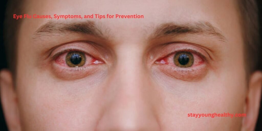 Eye Flu Causes, Symptoms, and Tips for Prevention